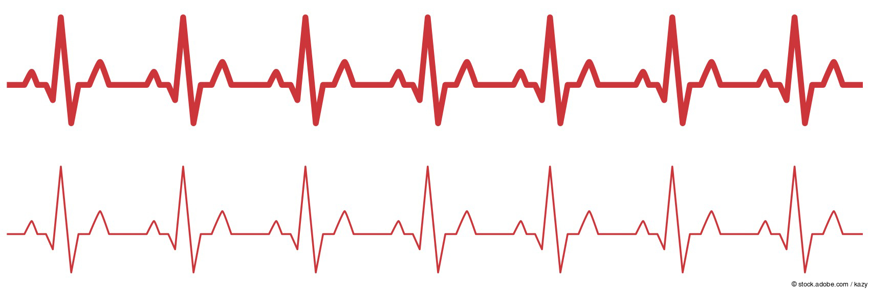 Was ist der Sinusrhythmus?